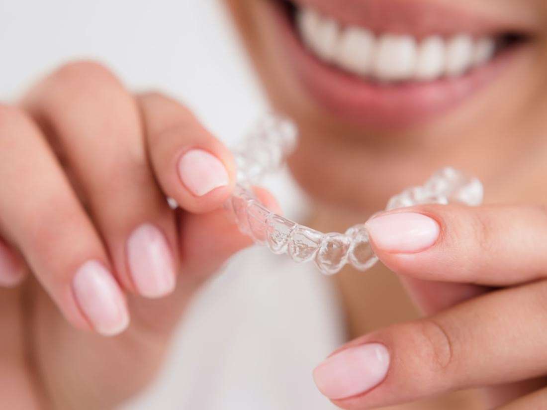The Top 5 Questions Aurora Patients Have About Invisalign® | Invisalign ...